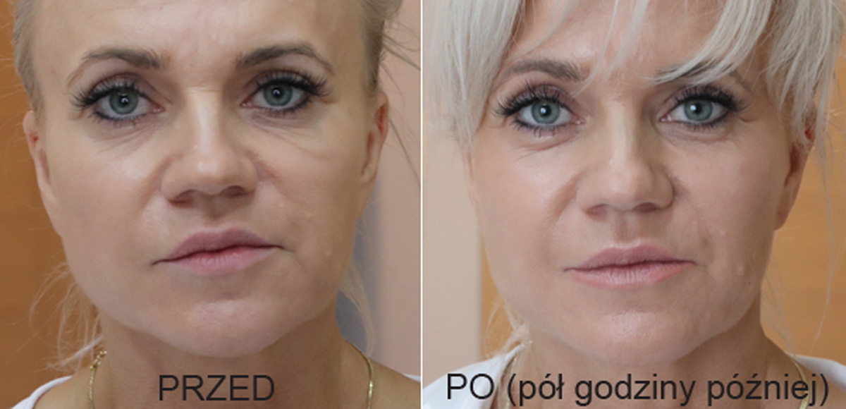 Asymetria twarzy, czyli jak w pół godziny poprawić życie - Dr Marek ...