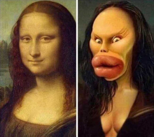 Powiększanie ust metodą rosyjską – skutki uboczne - Dr Marek Wasiluk ...